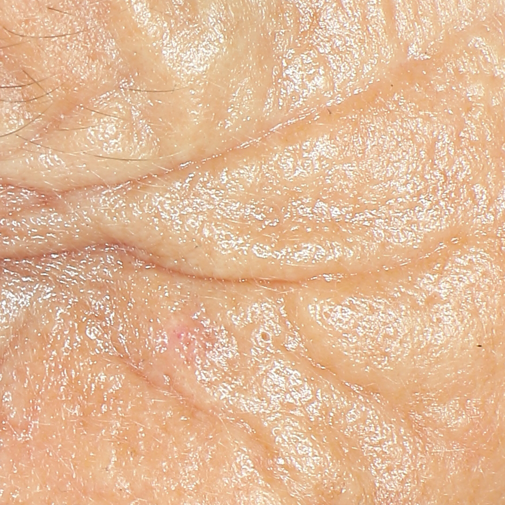 The Skin Method | AWvi